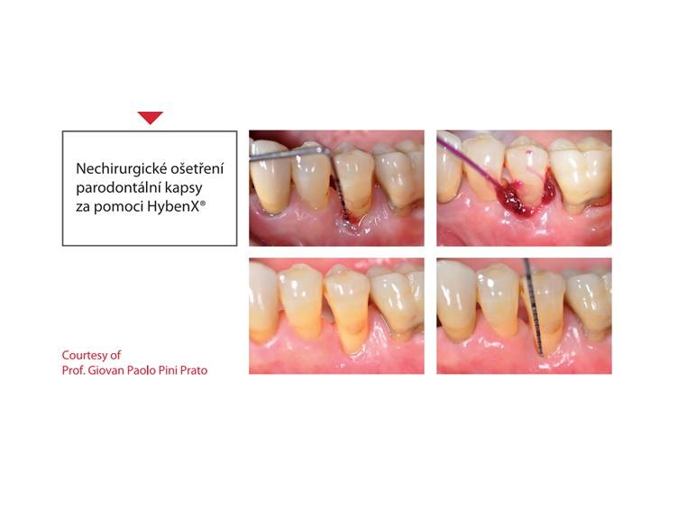 Profitime s.r.o. > Katalog produktů > HybenX